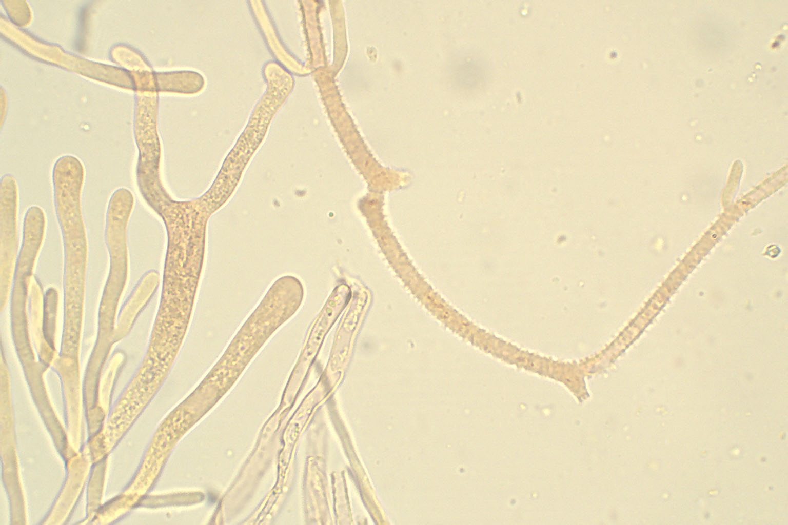 Dacrymyces chrysospermus – Gobe na Bovškem